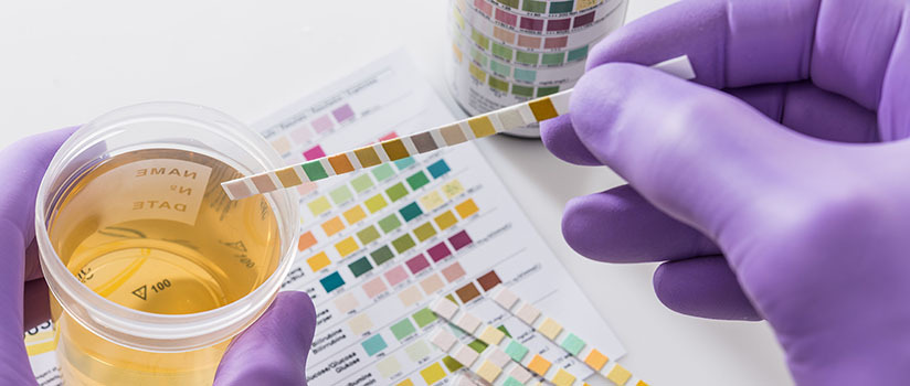 Forensic Drug Testing… | College of American Pathologists