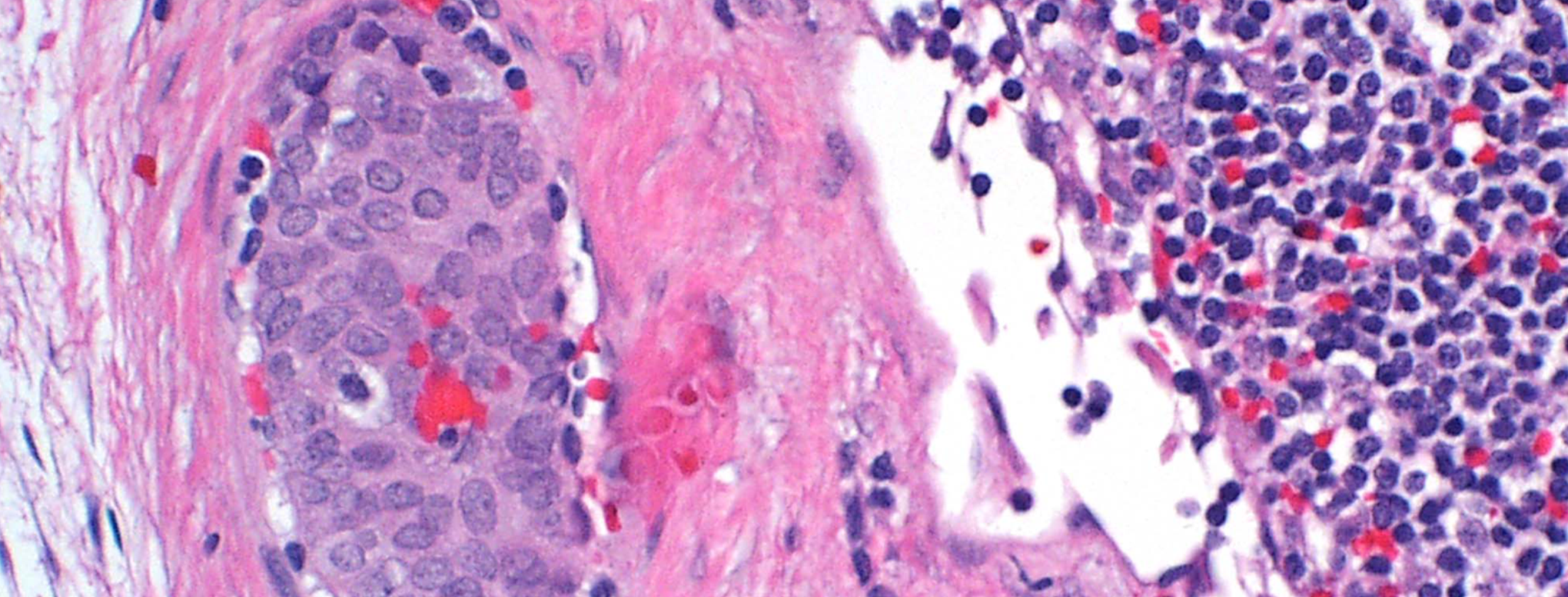 Protocols and Guidelines | College of American Pathologists
