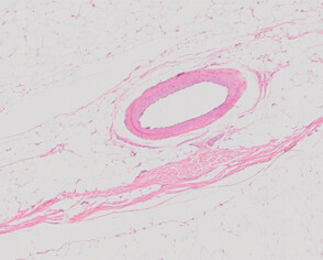 Left Flank | College of American Pathologists