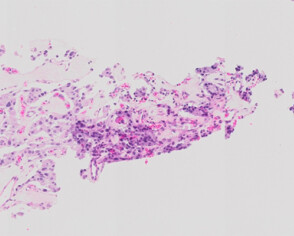 Retroperitoneum | College of American Pathologists