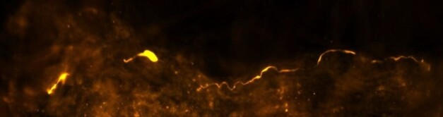 Phosphorylated Alpha-Synuclein in… | College of American Pathologists