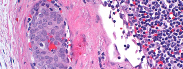 Protocols and Guidelines | College of American Pathologists