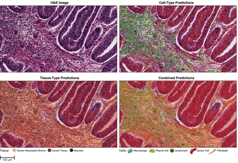 Machine Learning in Pathology: The… | College of American Pathologists