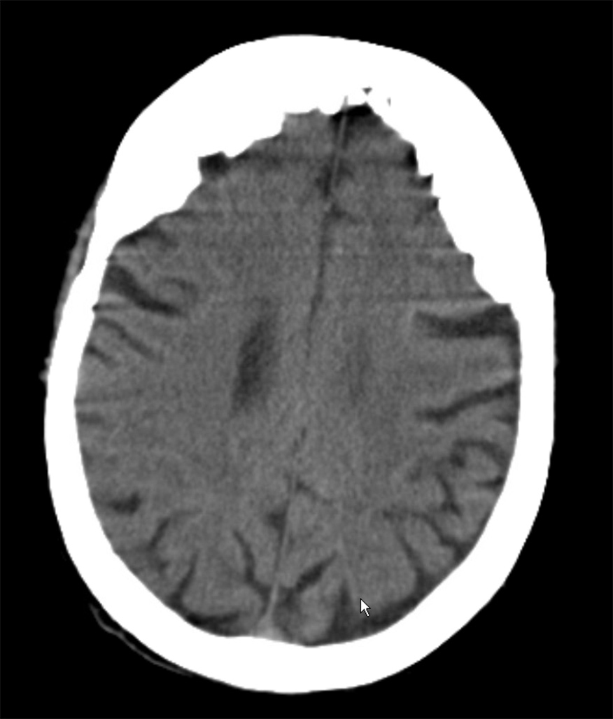 2019 NPA-07 | College of American Pathologists