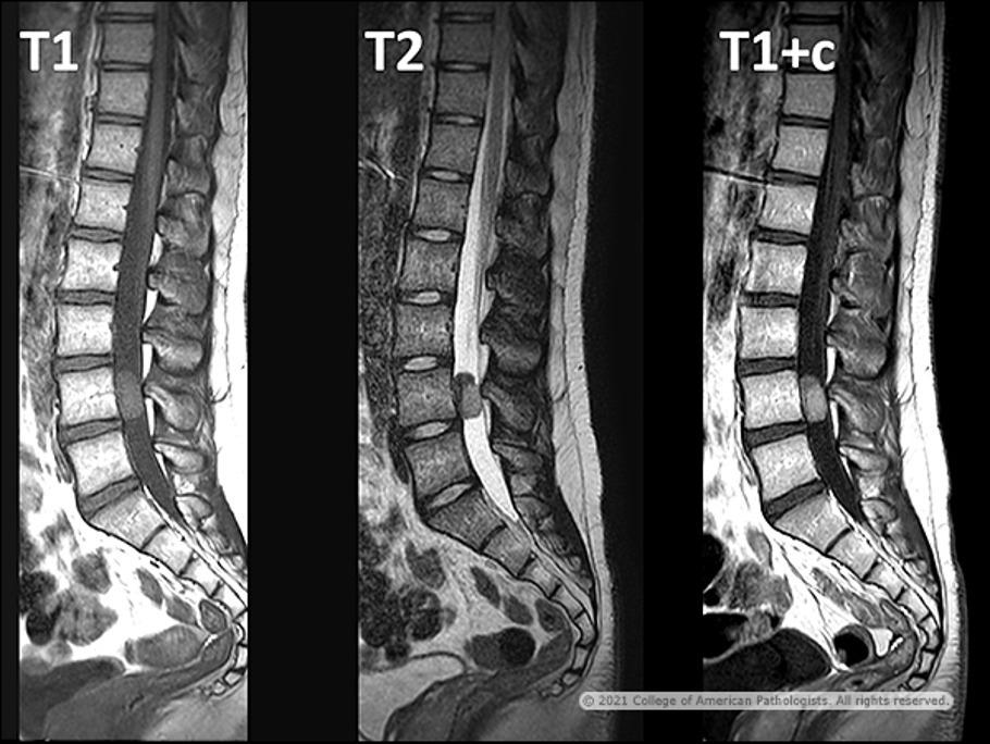 2021 NPA-01 | College of American Pathologists
