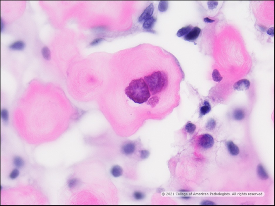 2021 NPA-01 | College of American Pathologists