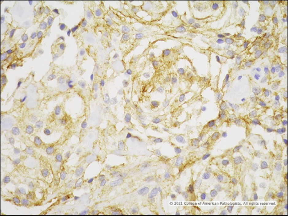 2021 NPA-01 | College of American Pathologists