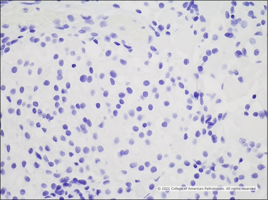 2021 NPA-01 | College of American Pathologists