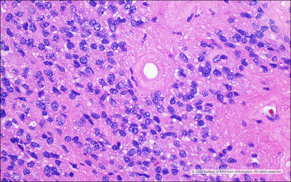 2021 NPA-02 | College of American Pathologists