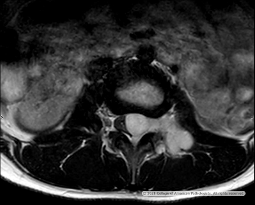 2021 NPA-03 | College of American Pathologists