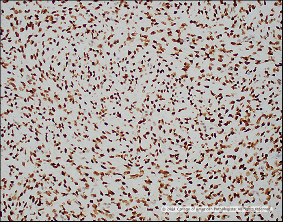 2021 NPA-03 | College of American Pathologists