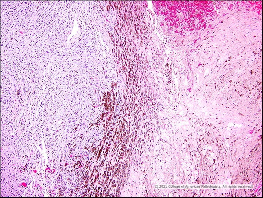 2021 NPA-04 | College of American Pathologists