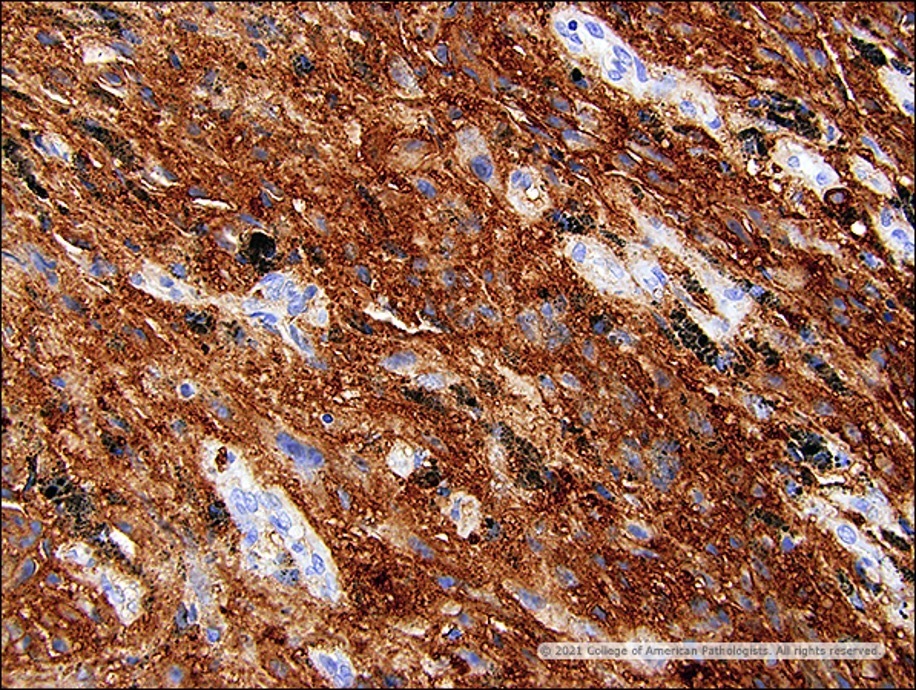 2021 NPA-04 | College of American Pathologists