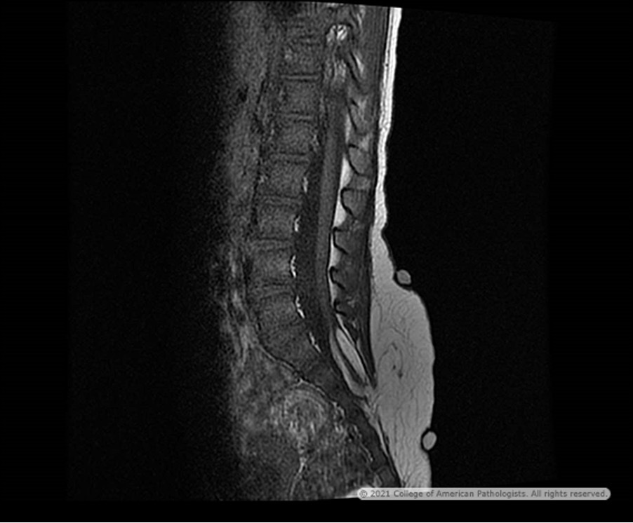 2021 NPA-06 | College of American Pathologists