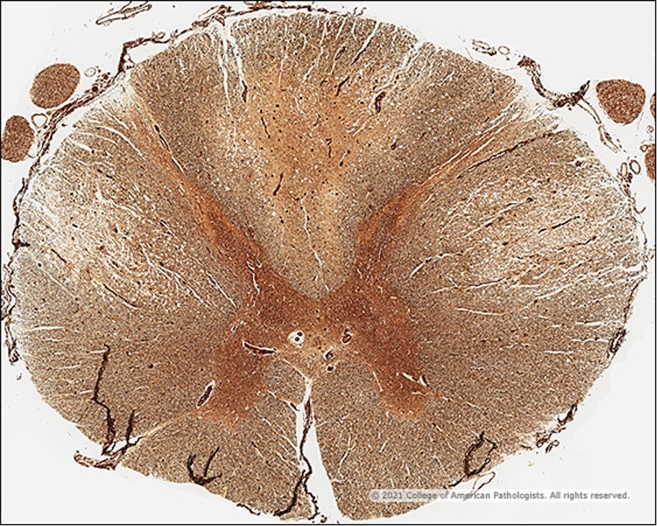 2021 NPA-07 | College of American Pathologists