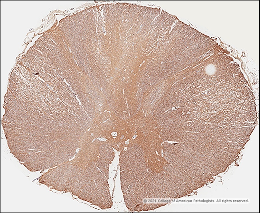 2021 NPA-07 | College of American Pathologists