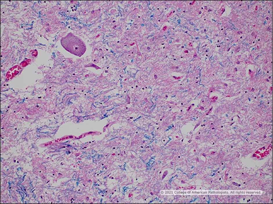 2021 NPA-08 | College of American Pathologists