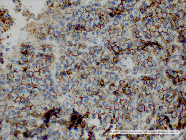 2019 NPA-01 | College of American Pathologists