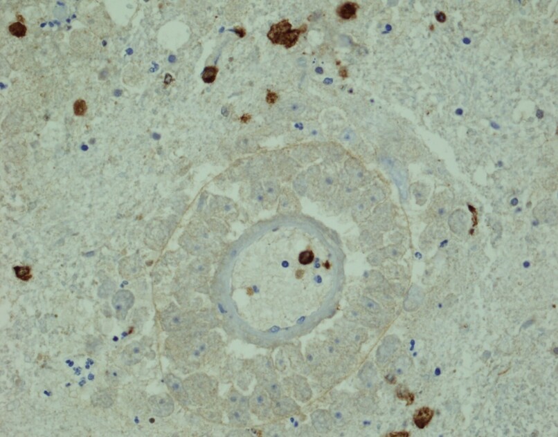 2017 NPA-02 | College of American Pathologists