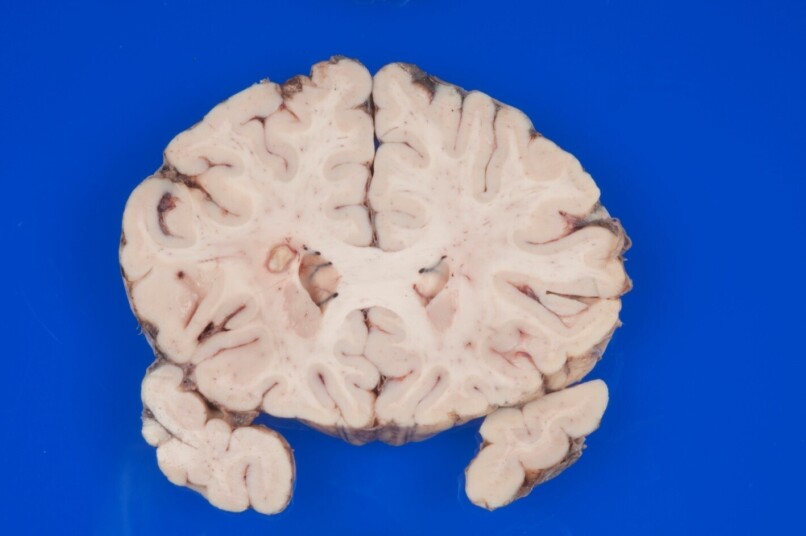 2017 NPA-03 | College of American Pathologists