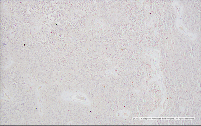 2021 NPA-02 | College of American Pathologists