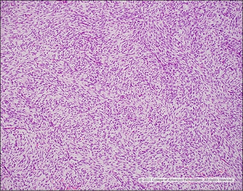 2021 NPA-03 | College of American Pathologists