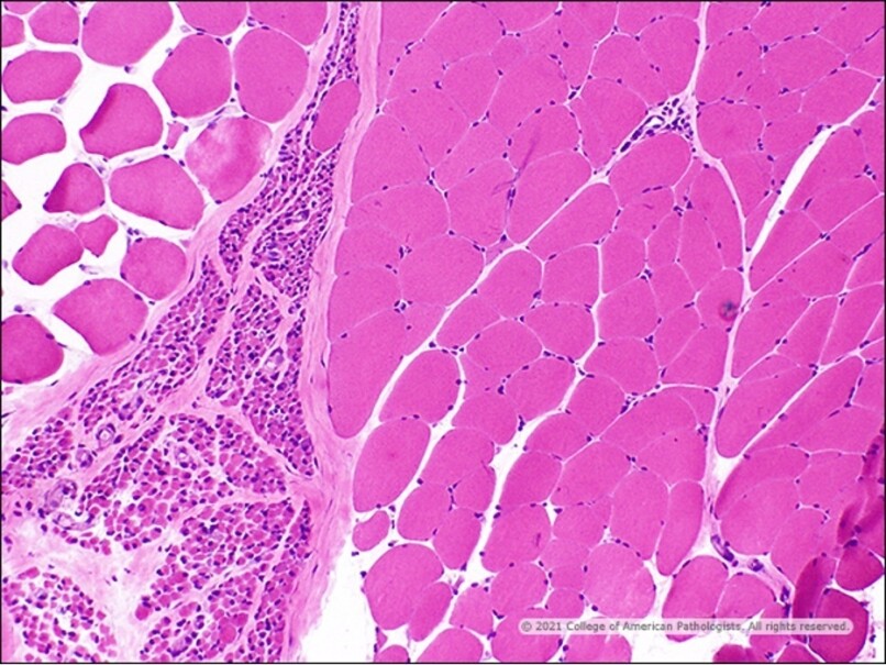 2021 NPA-05 | College of American Pathologists