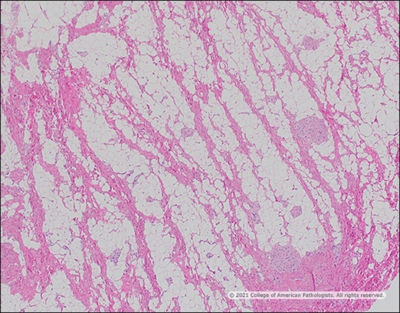 2021 NPA-06 | College of American Pathologists