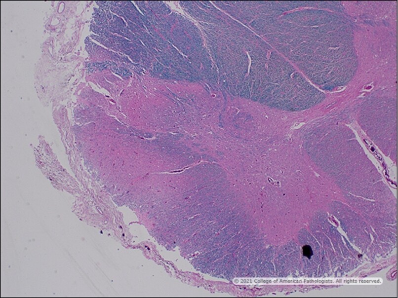 2021 NPA-08 | College of American Pathologists