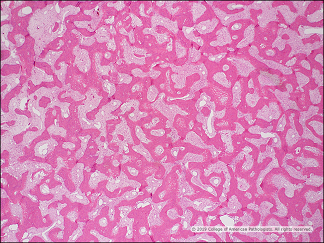 2019 NPA-04 | College of American Pathologists